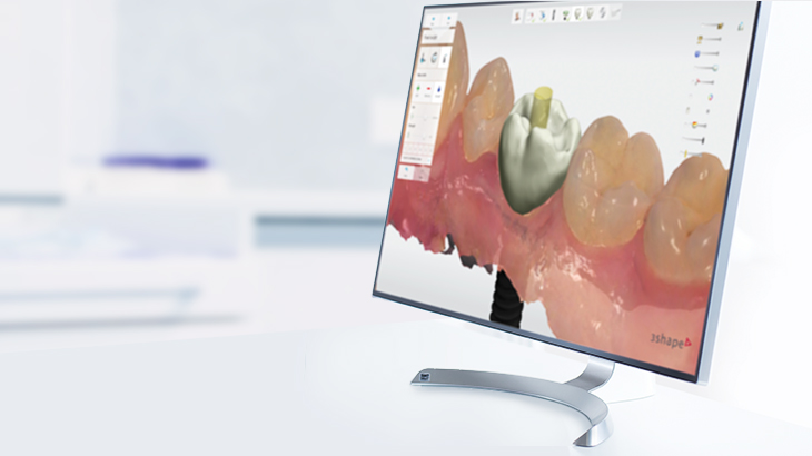 3Shape Engagement Suite CAD/CAM Software | Patterson Dental