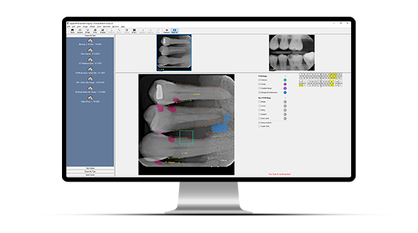 Eaglesoft Upgrade - Practice Management | Patterson Dental